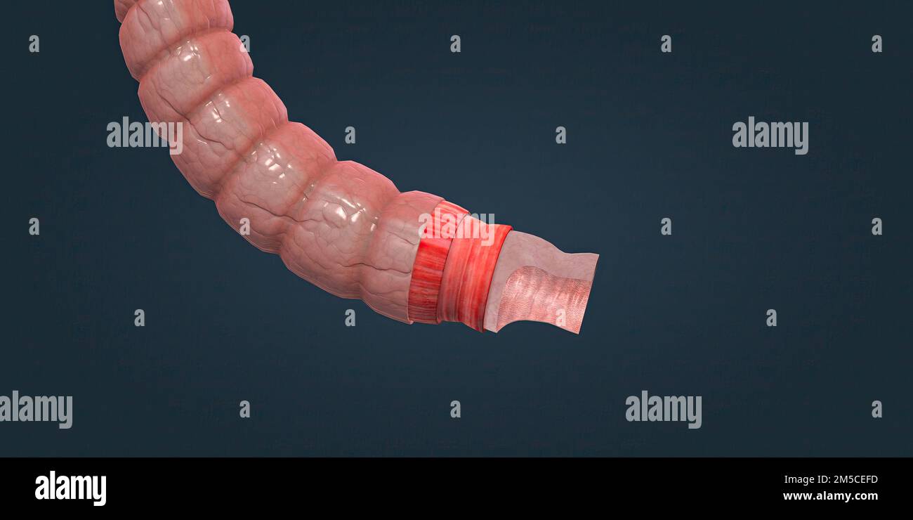 Mucosa and submucosa large intestine hi-res stock photography and ...