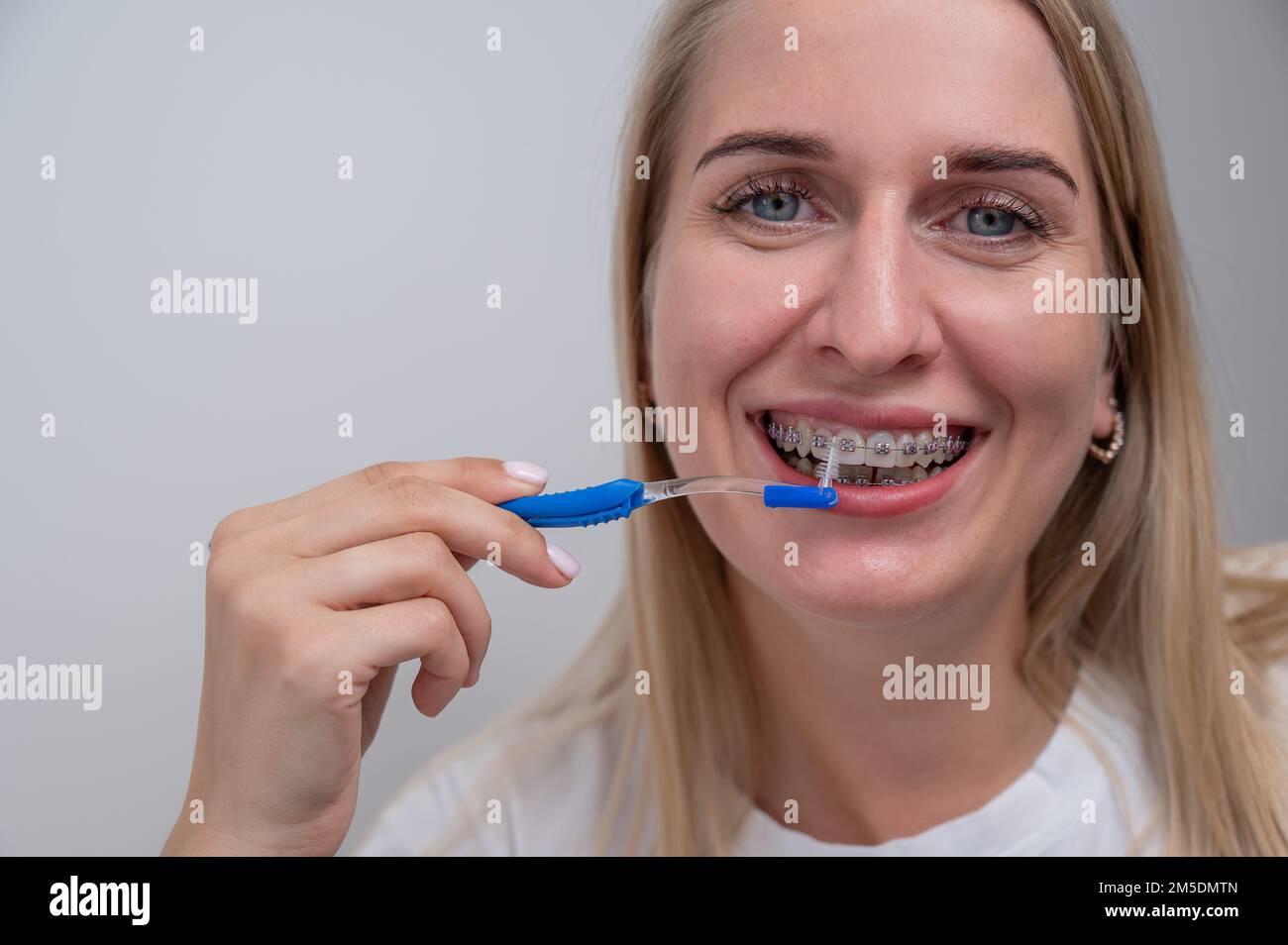 Caucasian Woman Cleaning Her Teeth With Braces Using A Brush Stock