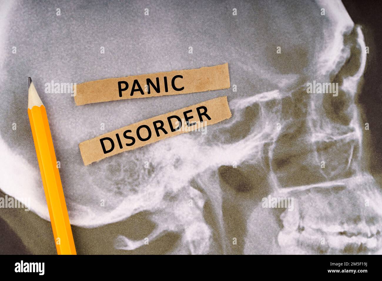 Medical concept. On x-rays of a human skull, a pencil and strips of ...