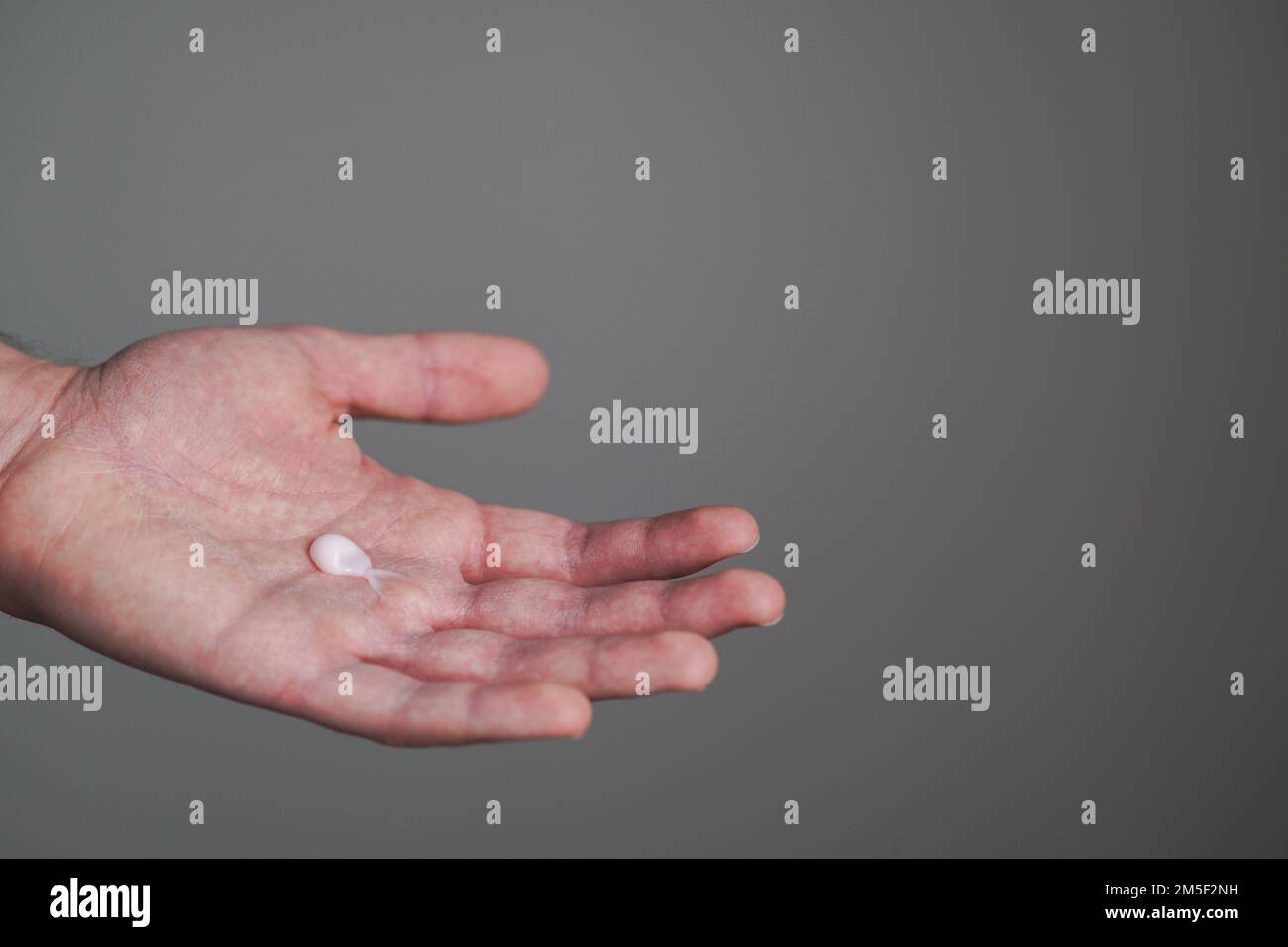 Dry male hands. Man putting hand cream on his dry hands. Man applying ...