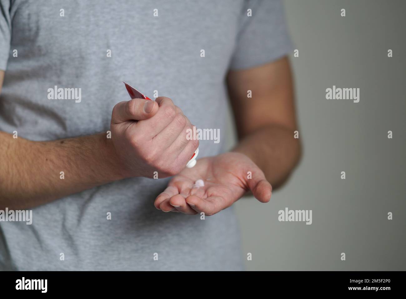Dry male hands. Man putting hand cream on his dry hands Stock Photo - Alamy