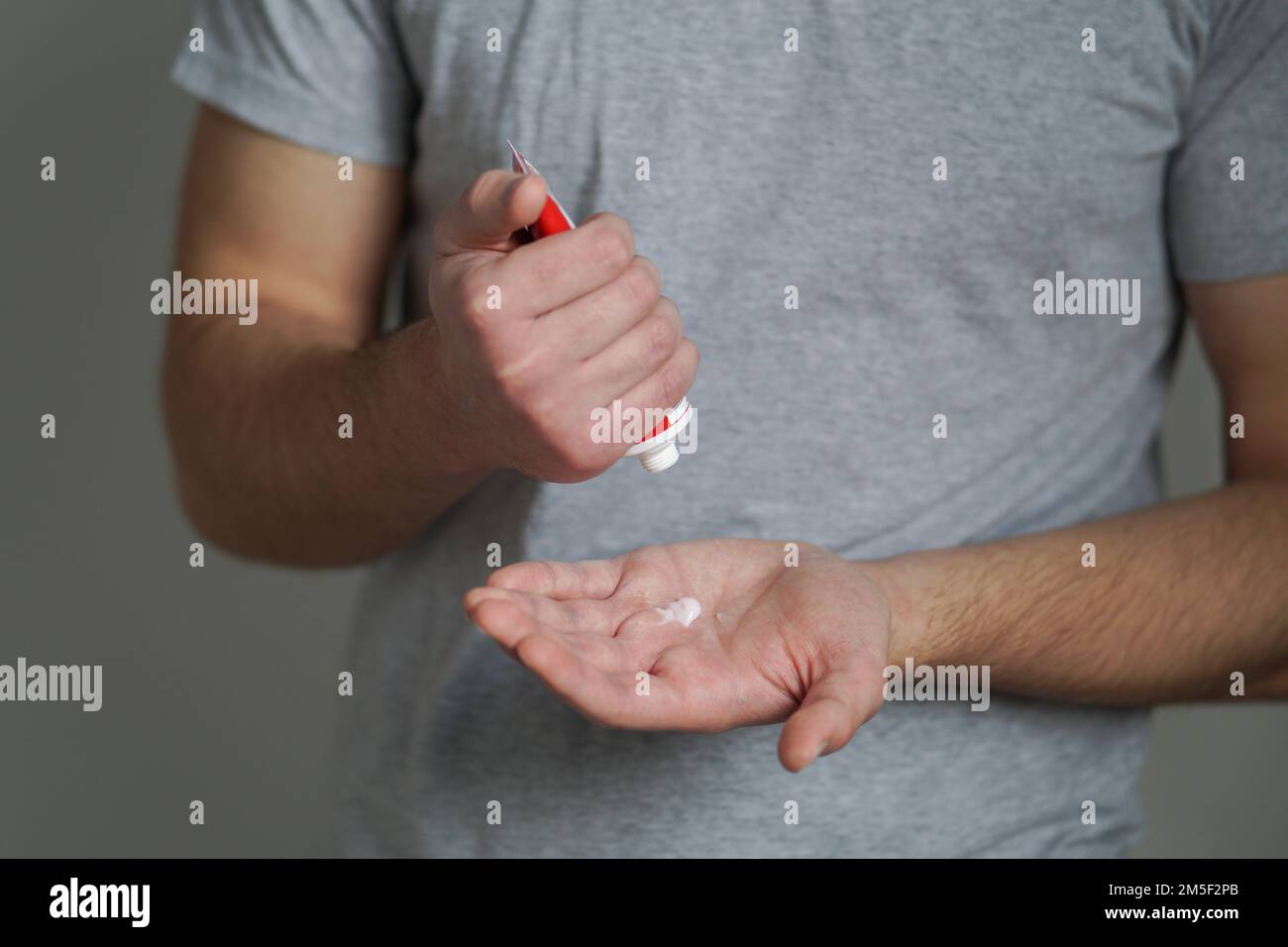 Dry male hands. Man putting hand cream on his dry hands. Man applying ...