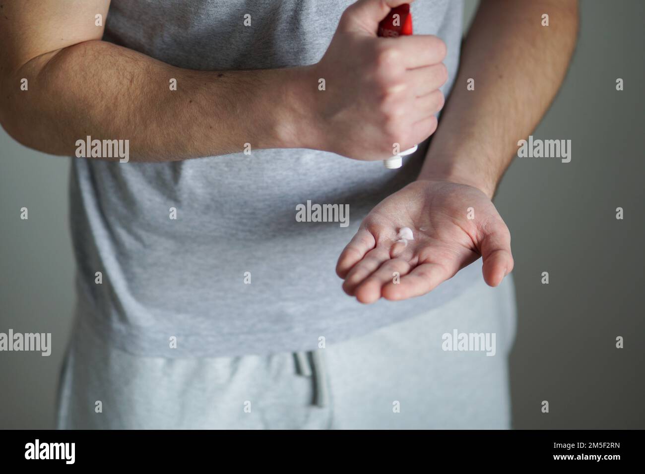 Dry male hands. Man putting hand cream on his dry hands. Man applying ...