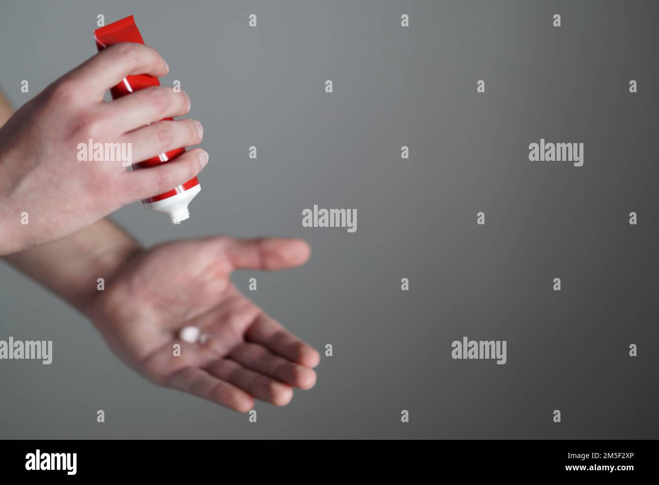 Dry male hands. Man putting hand cream on his dry hands. Man applying ...