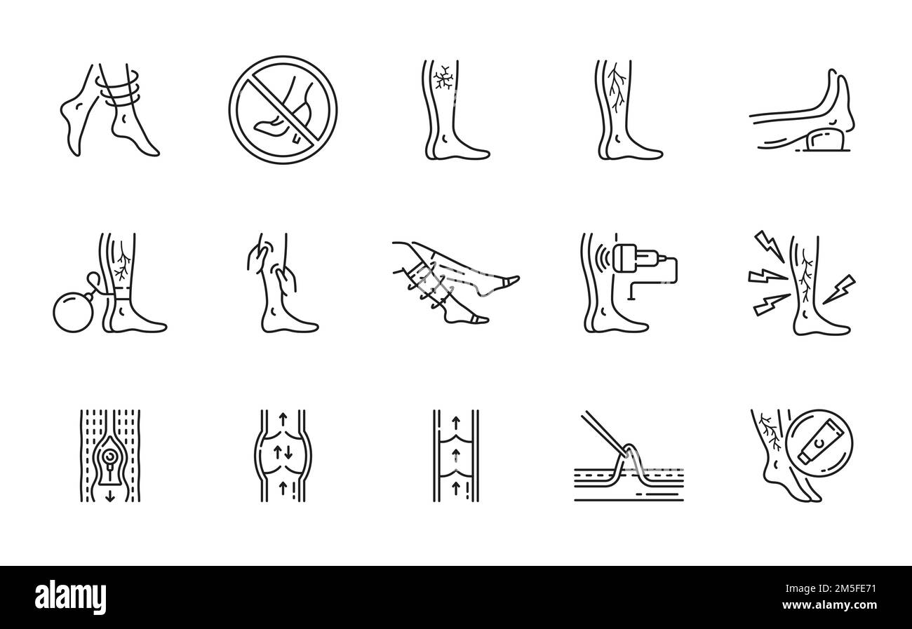 Varicose treatment icons, leg veins thrombosis disease and surgery ...
