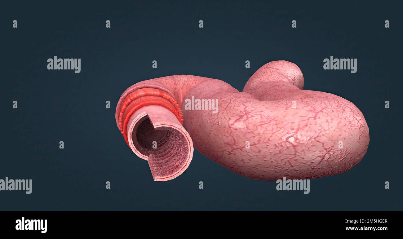 Mucosa and submucosa large intestine hi-res stock photography and ...