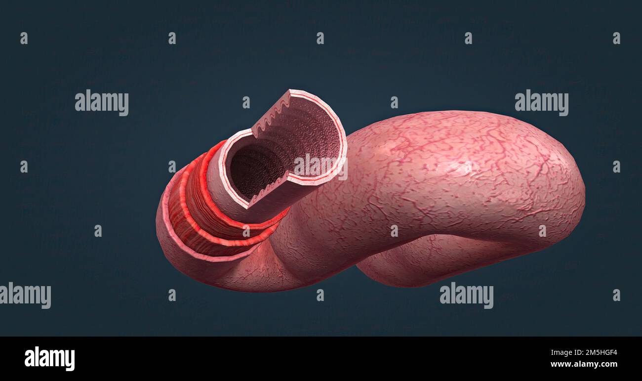 Mucosa and submucosa large intestine hi-res stock photography and ...