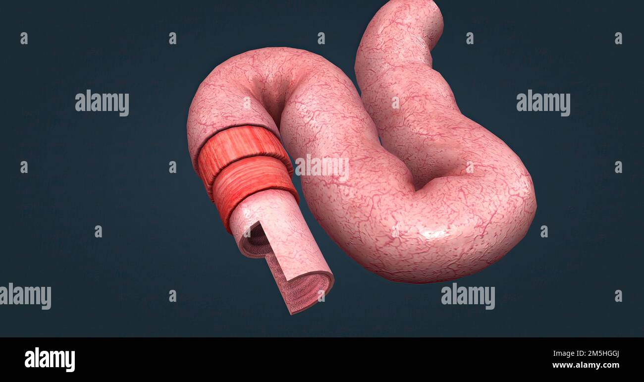 Mucosa and submucosa large intestine hi-res stock photography and ...