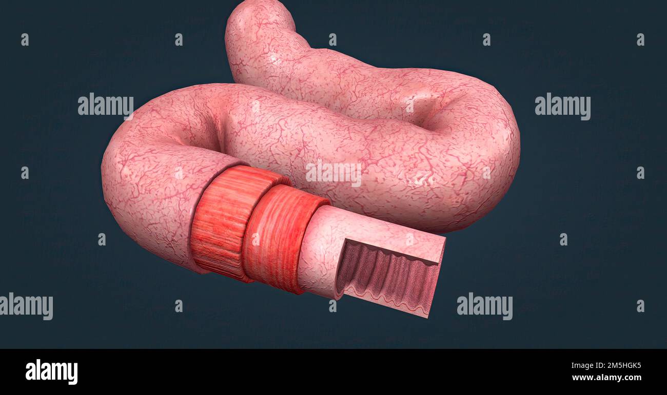 Mucosa and submucosa large intestine hi-res stock photography and ...