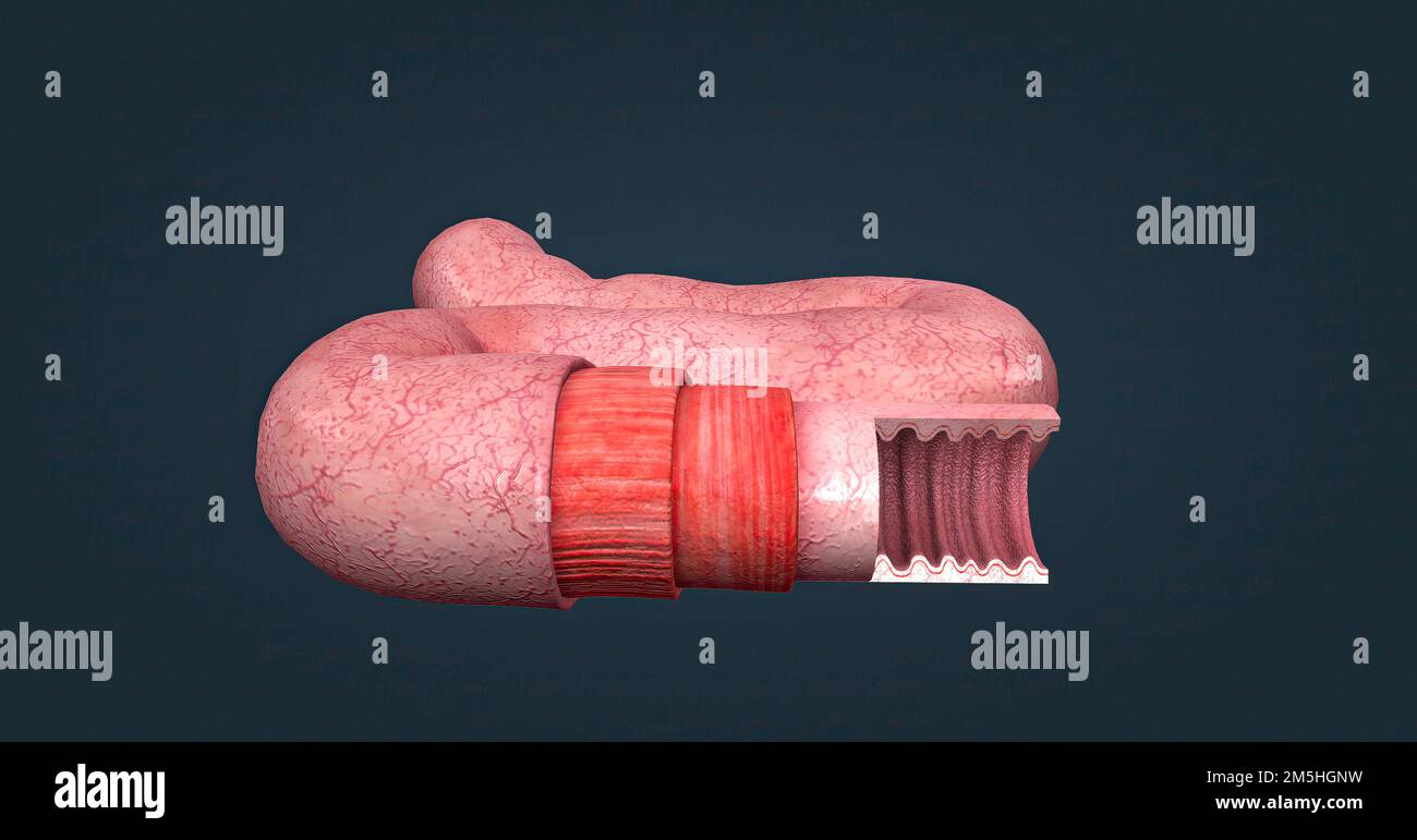 Mucosa and submucosa large intestine hi-res stock photography and ...