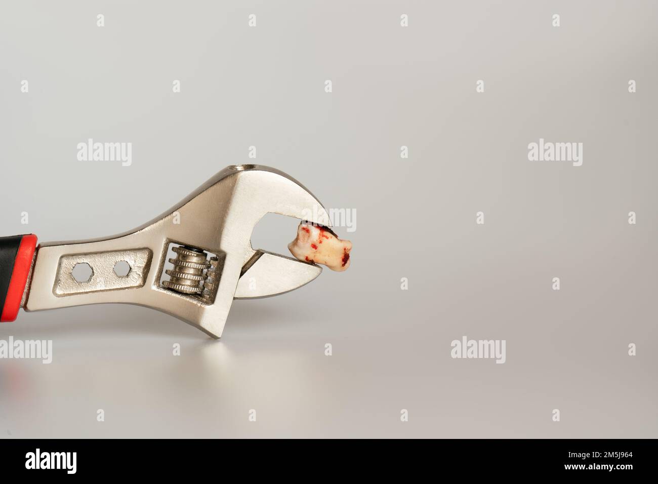 Tooth extraction with dental tools with caries by a professional ...