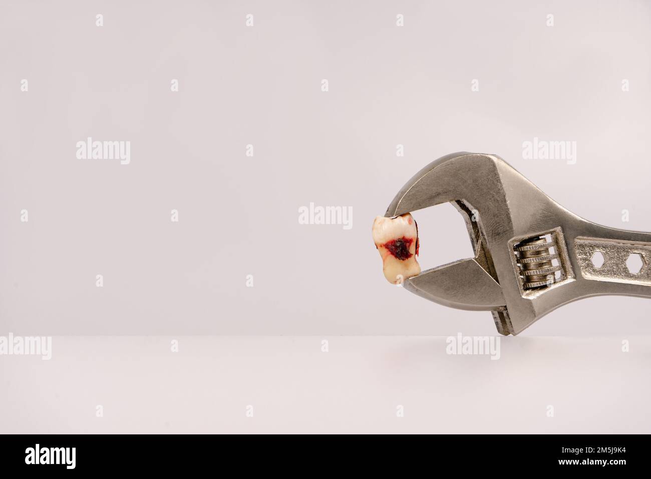 Tooth extraction with dental tools with caries by a professional ...