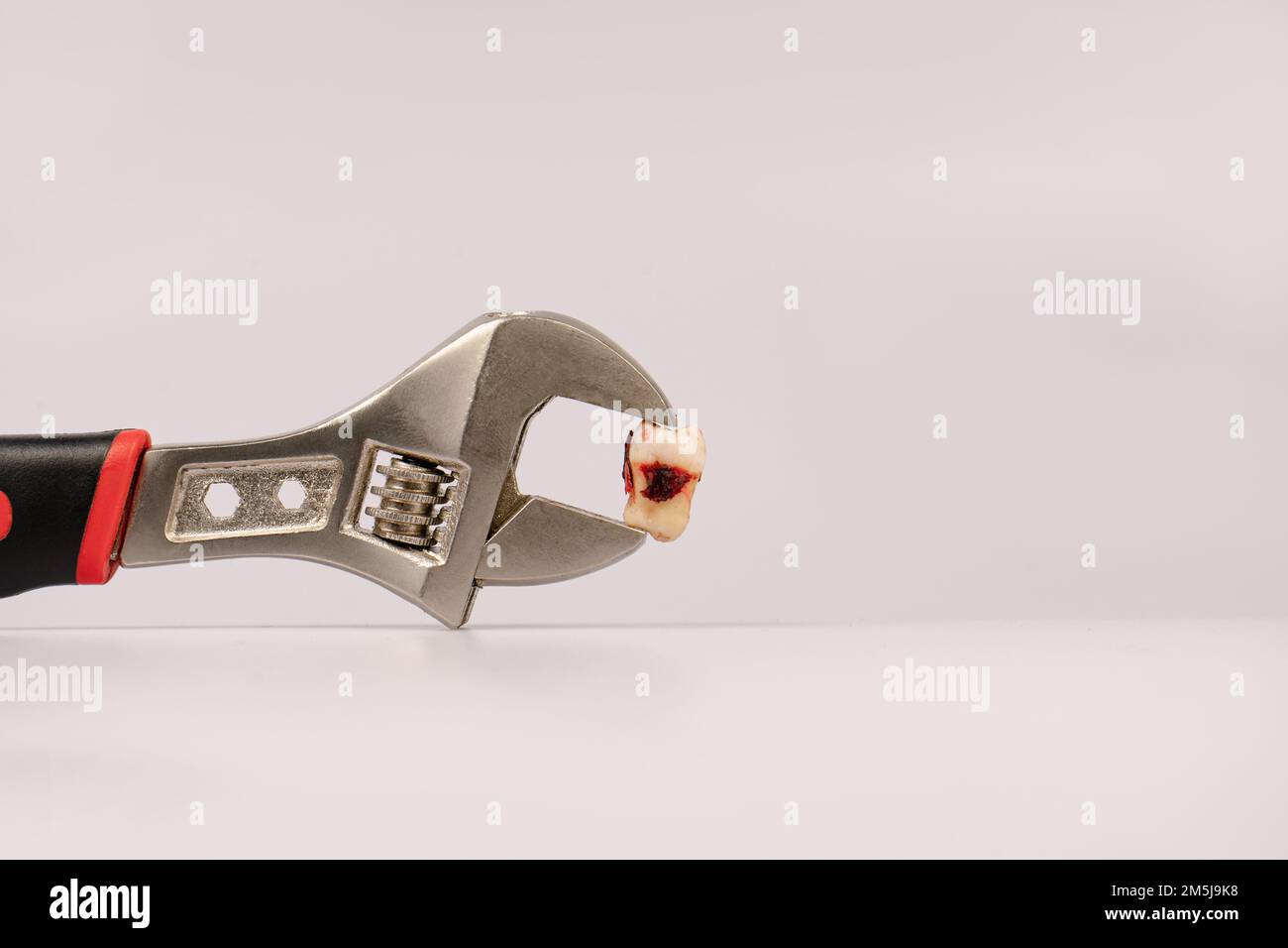 Tooth extraction with dental tools with caries by a professional ...