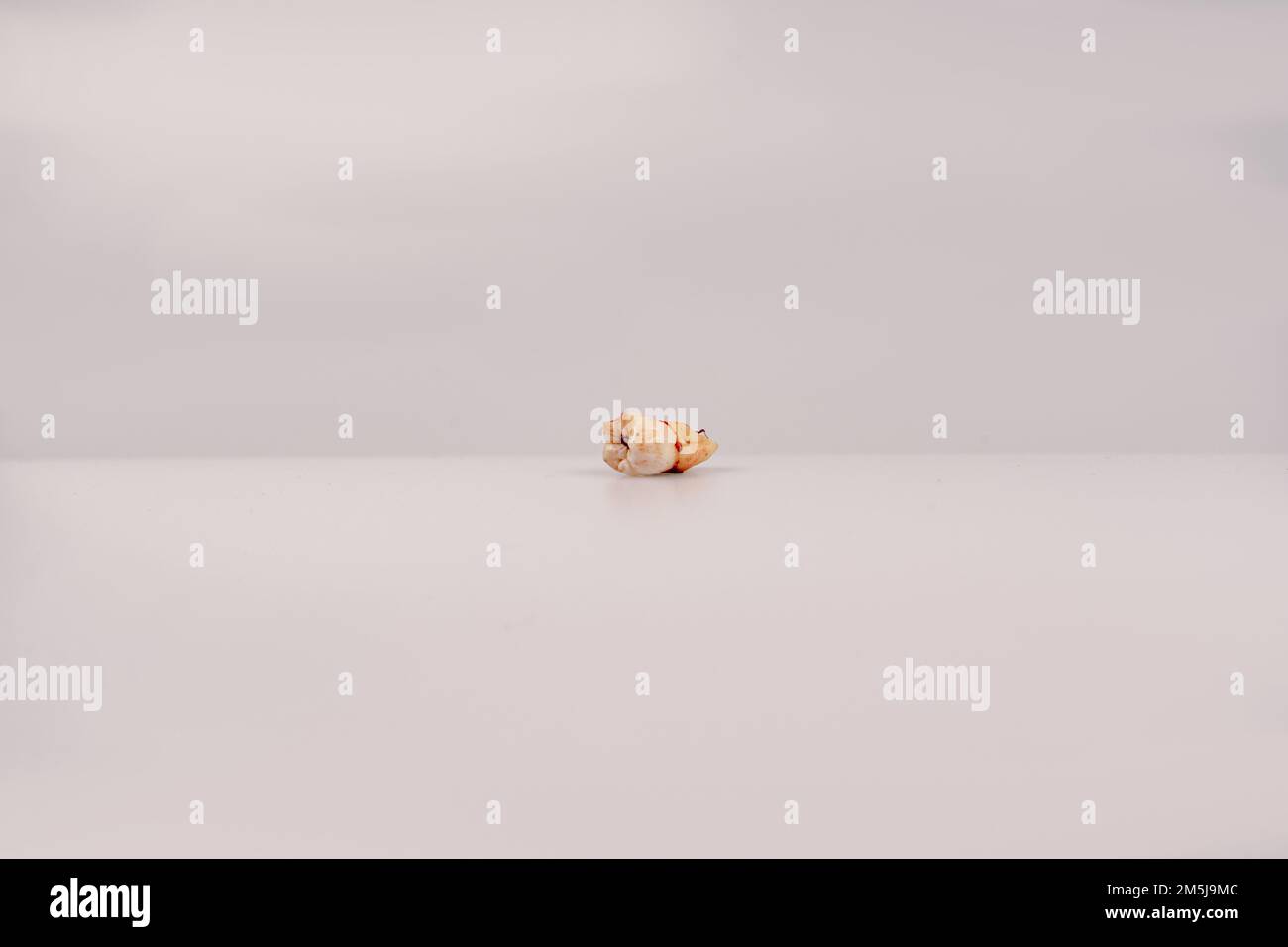 Human wisdom tooth isolated on gray background. Dentistry concept ...