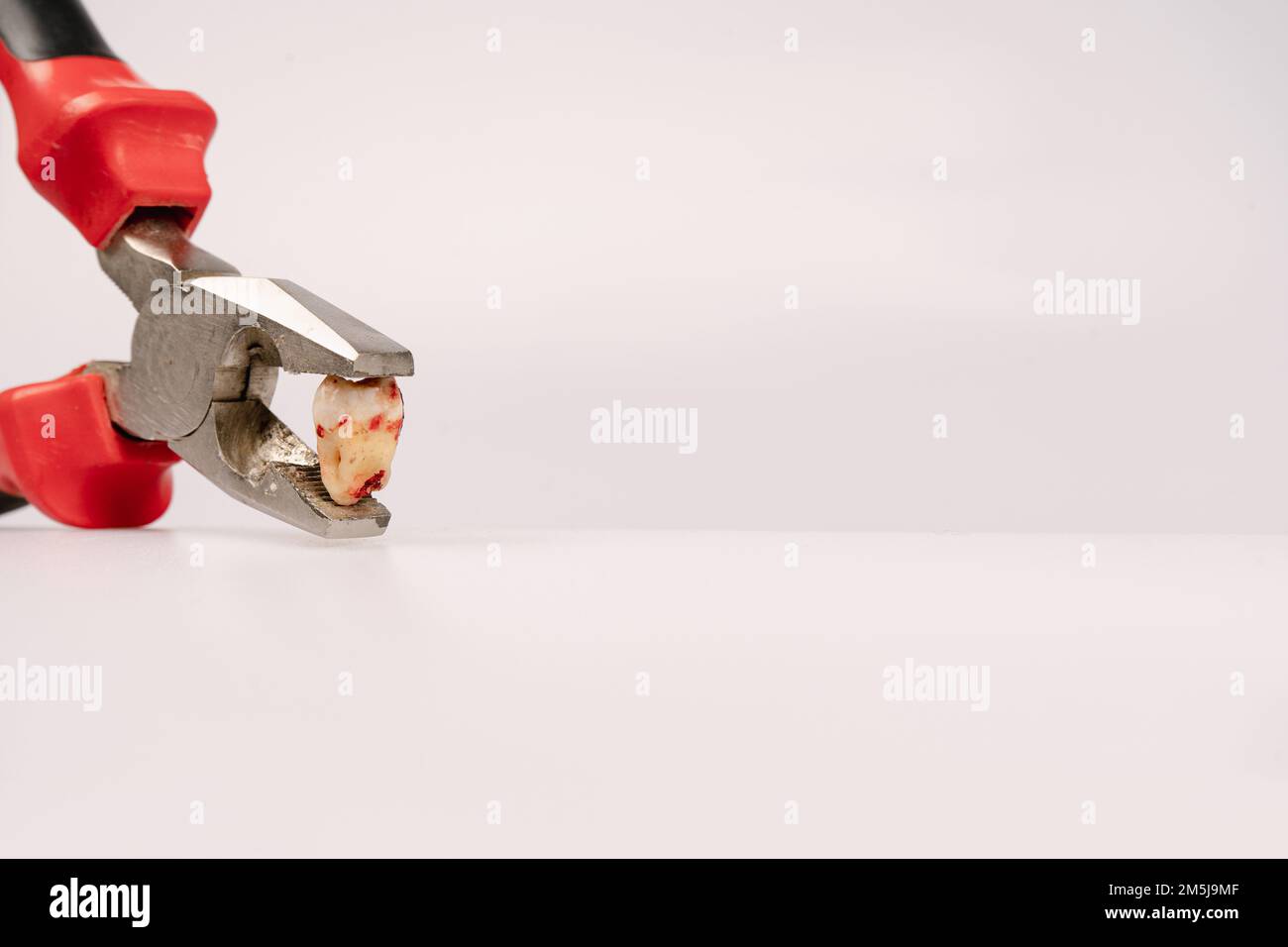 Tooth extraction with dental tools with caries by a professional ...