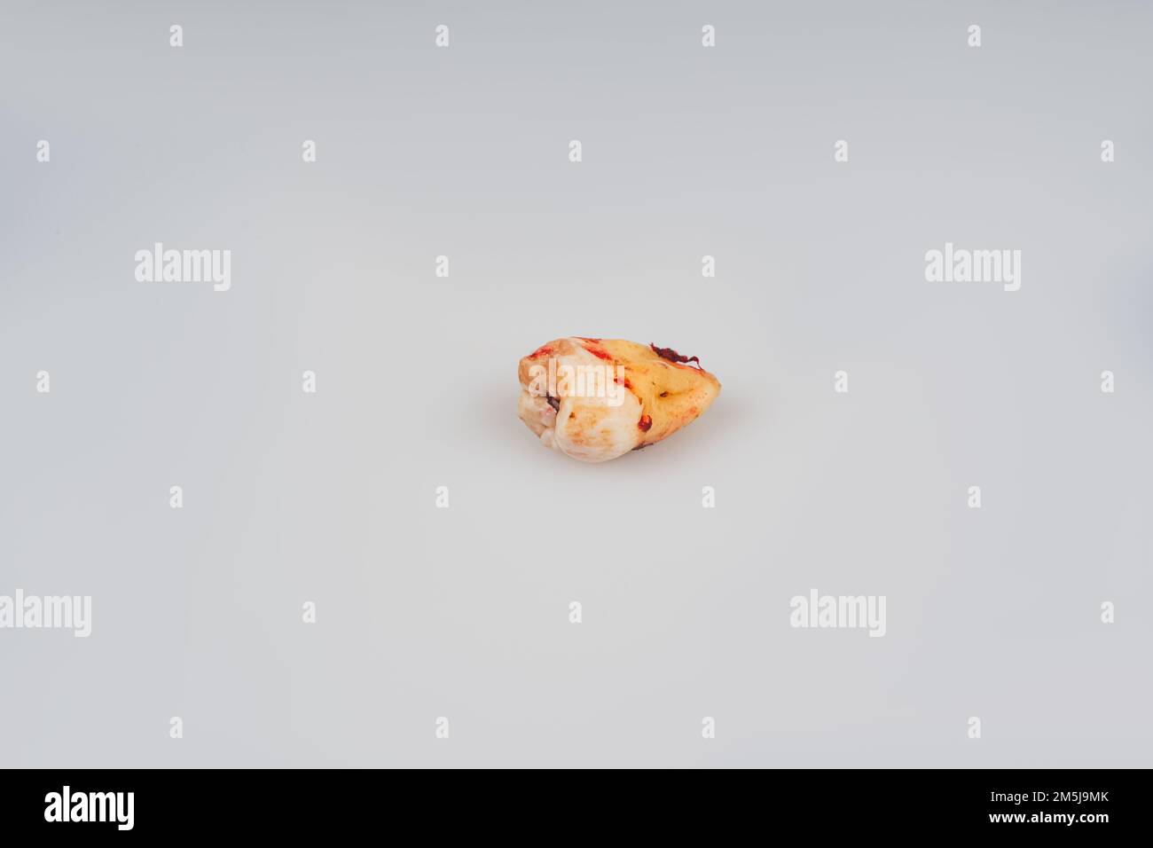 Human wisdom tooth isolated on gray background. Dentistry concept ...