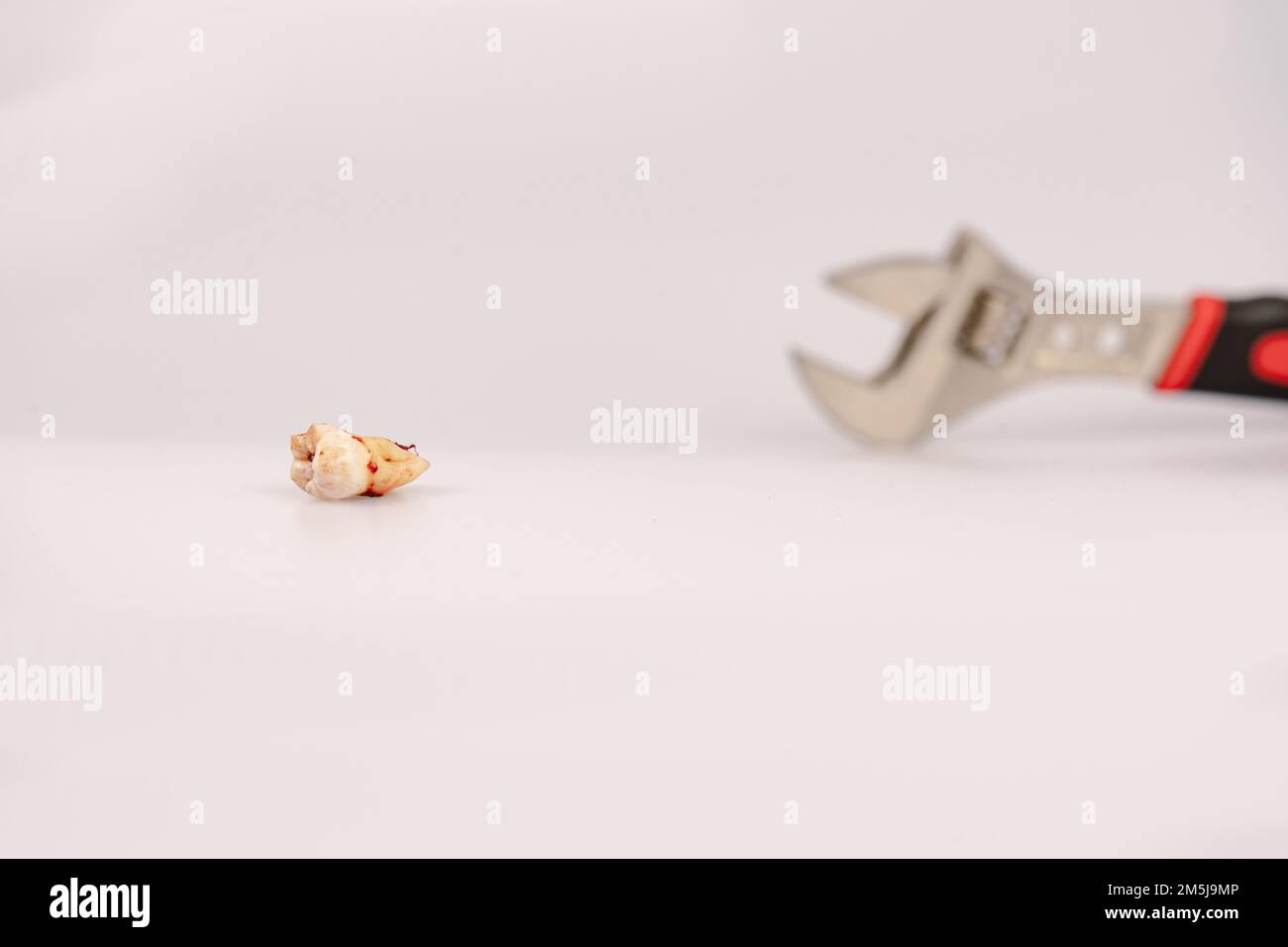 Tooth extraction with dental tools with caries by a professional ...