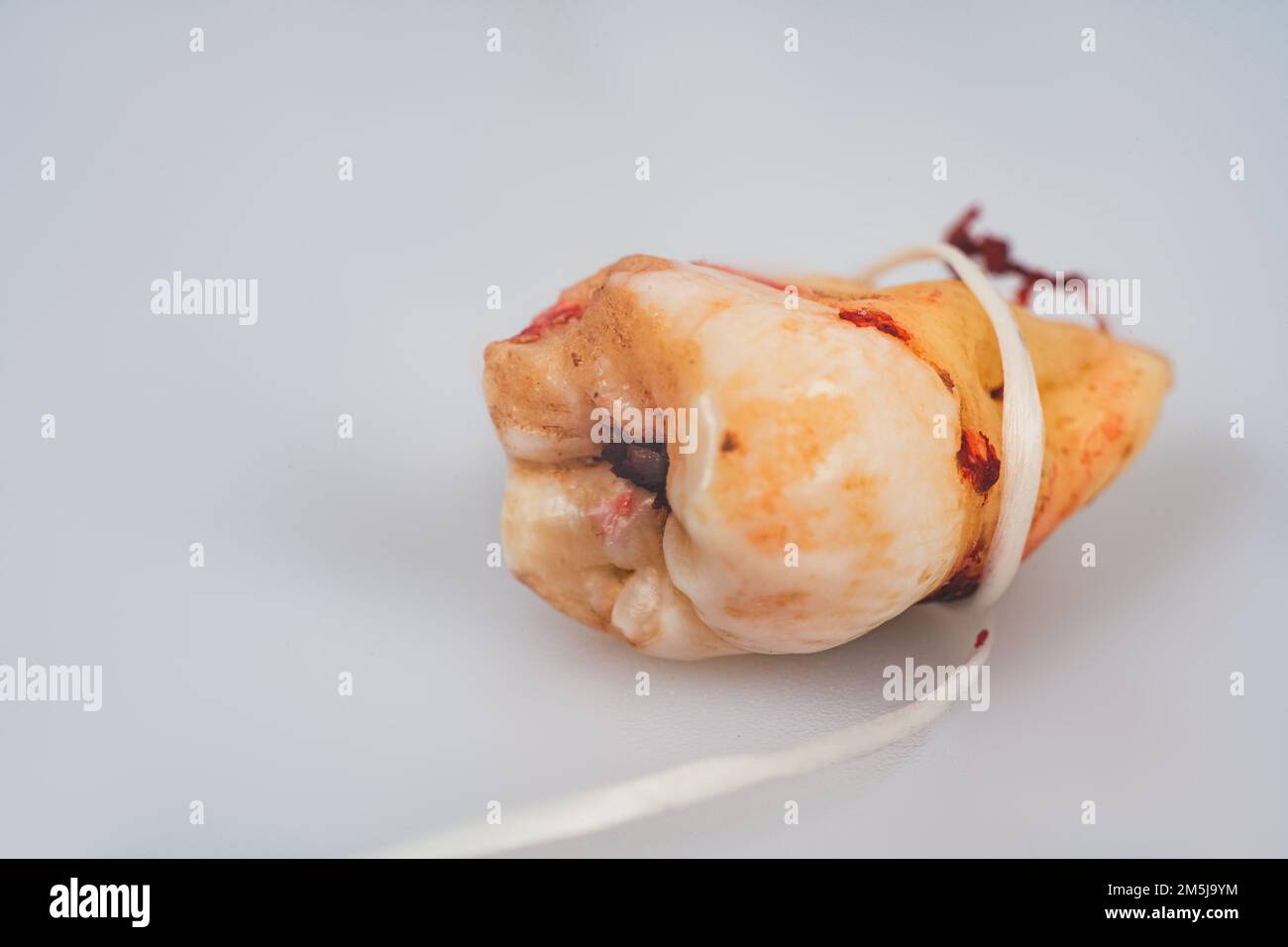 Human wisdom tooth isolated on gray background. Dentistry concept ...