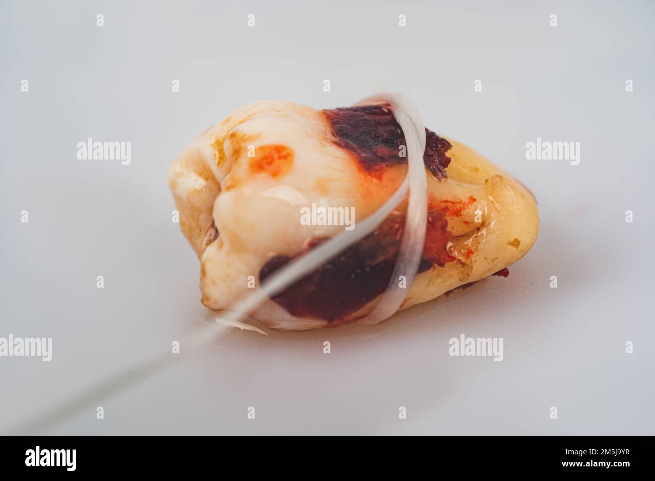Human wisdom tooth isolated on gray background. Dentistry concept ...