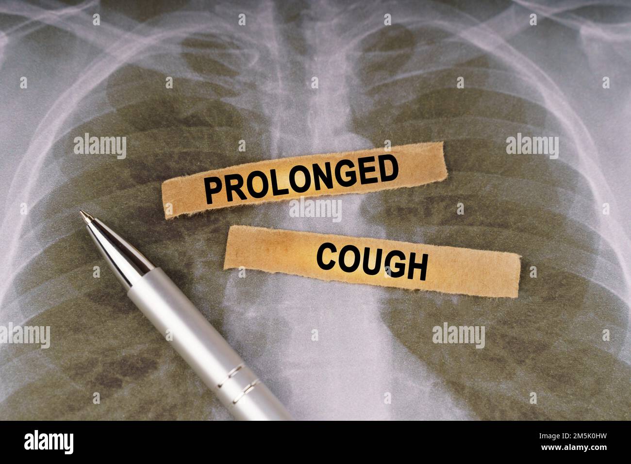 Medical concept. On a human chest x-ray, a pen and strips of paper ...