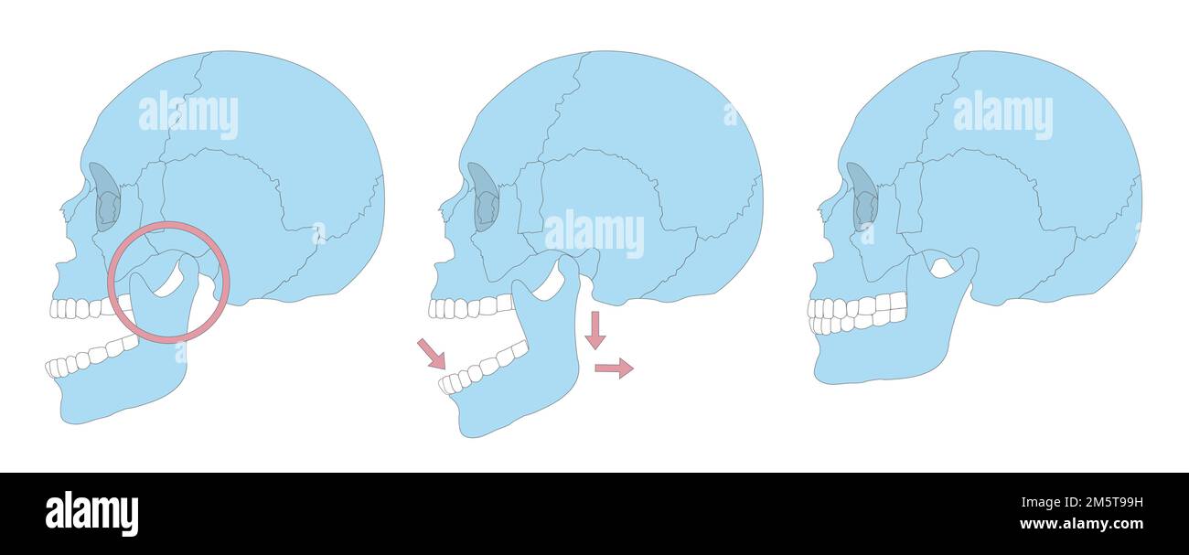 3d ct scan human head Stock Vector Images - Alamy