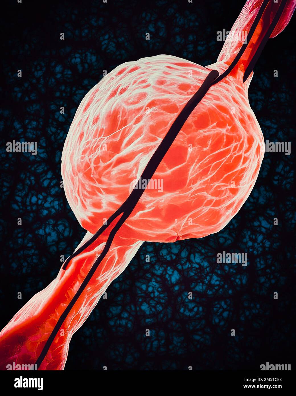 Abstract pathogenic virus cell, cancer cell under microscope, malignant ...