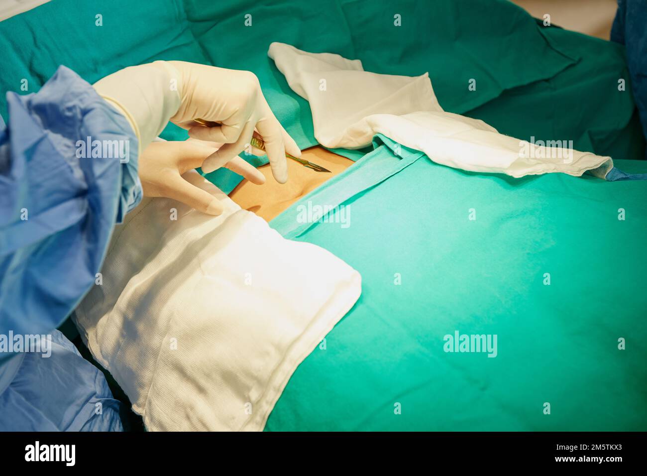 Carefully making the first incision. a surgeon making an incision with ...