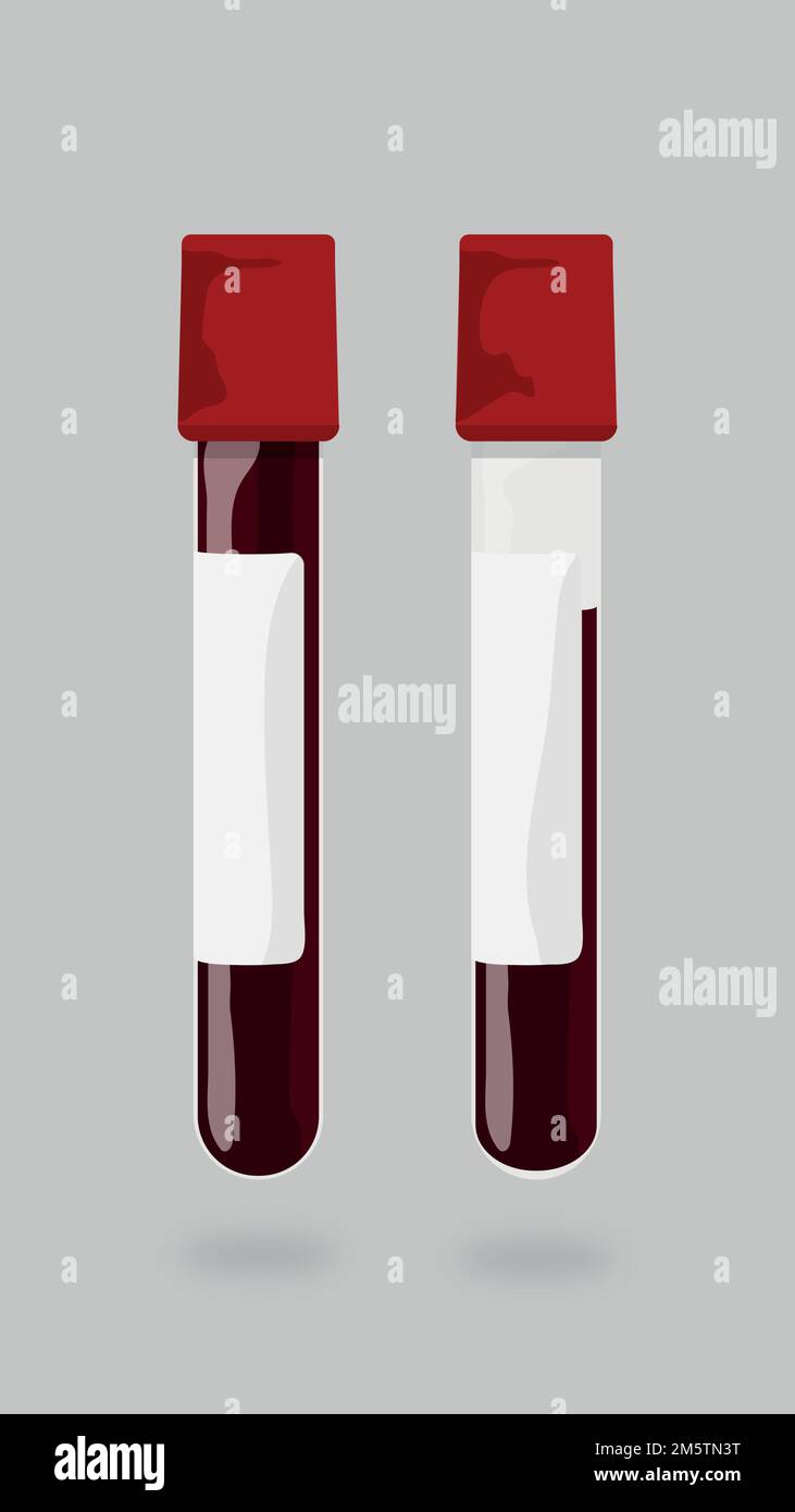 Coronavirus blood test tubes vector Stock Vector Image & Art - Alamy