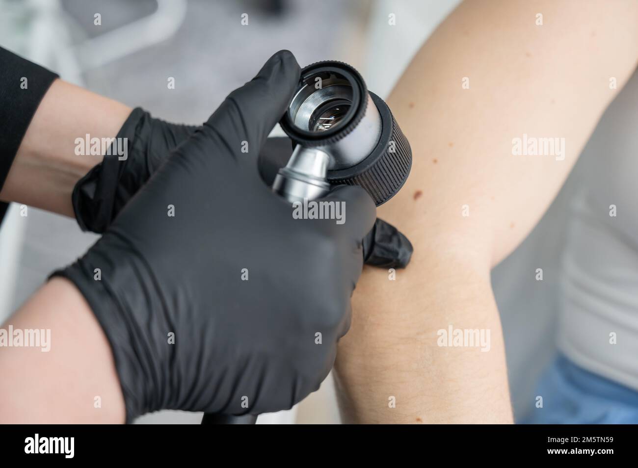 A dermatologist examines a patient's mole through a dermatoscope Stock ...