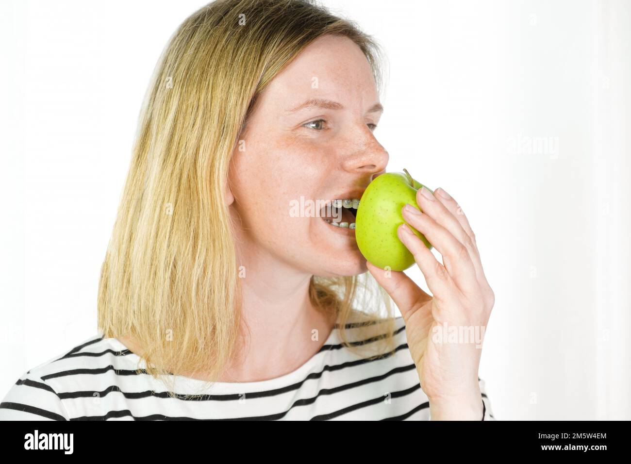 Young woman with dental braces biting green apple isolated light ...