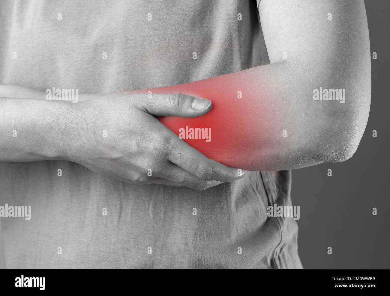 Hand, arm trauma, muscle ache, pain concept. Injury closeup. High ...