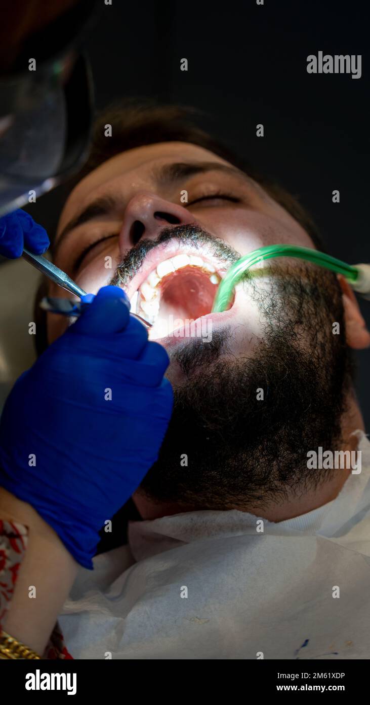 Tooth decay prevention. man in the dentist chair during a dental ...