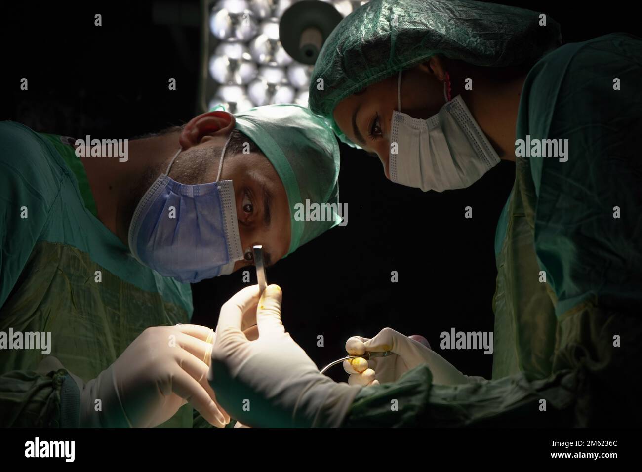 rhinoplasty surgery, defects in the shape of the nose in the female ...