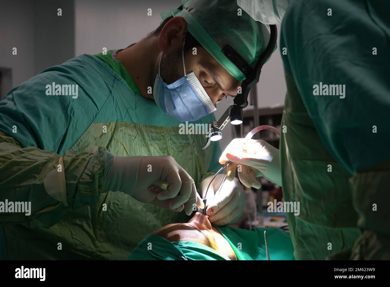 rhinoplasty surgery, defects in the shape of the nose in the female ...