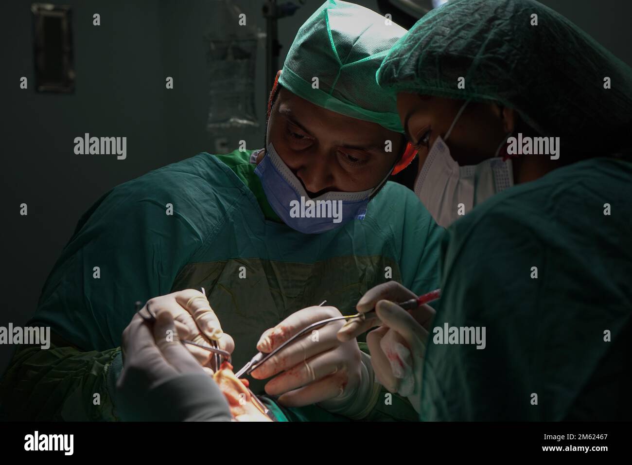 rhinoplasty surgery, defects in the shape of the nose in the female ...