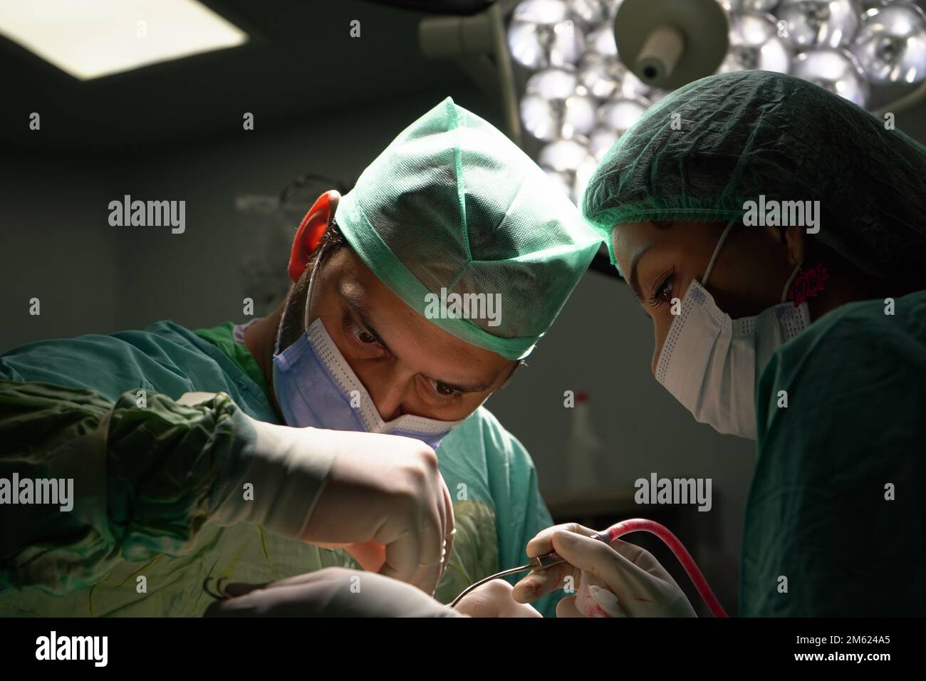 rhinoplasty surgery, defects in the shape of the nose in the female ...