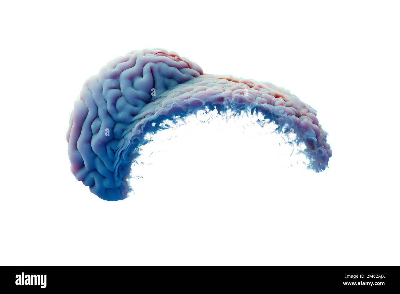 Memory lapses, forgetting things, degenerative disease. Brain problems ...