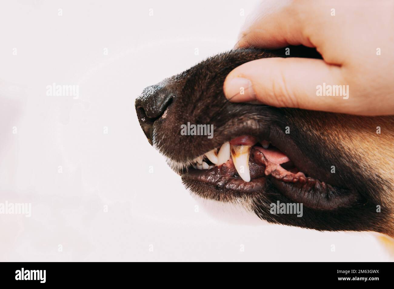 Cavities tooth hi-res stock photography and images - Alamy