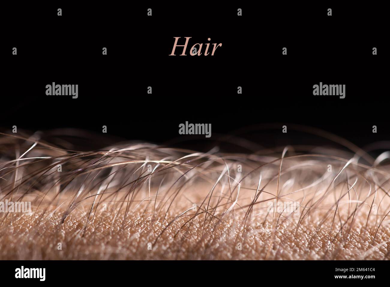 Human skin with hair on black background. Goose bumps Stock Photo - Alamy