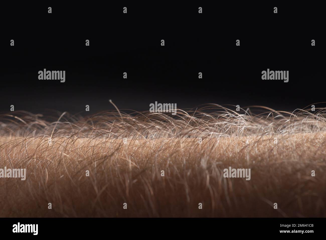 Human skin with hair on black background. Goose bumps Stock Photo - Alamy