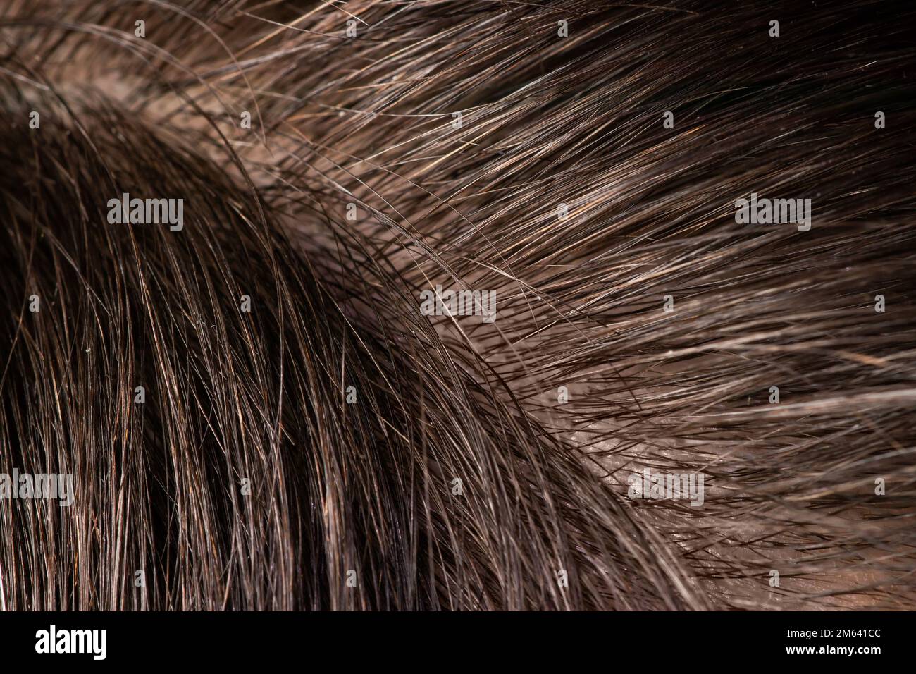 Super macro close up hair and scalp Stock Photo - Alamy