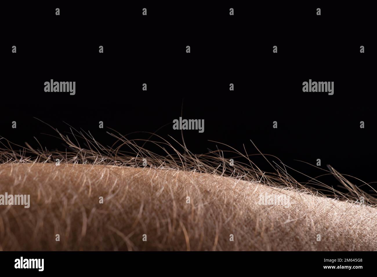 Human skin with hair on black background. Goose bumps Stock Photo - Alamy