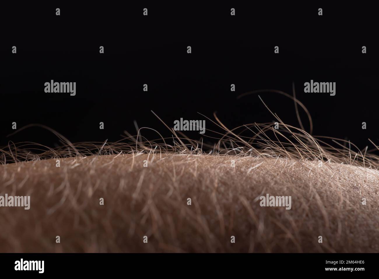 Human skin with hair on black background. Goose bumps Stock Photo - Alamy