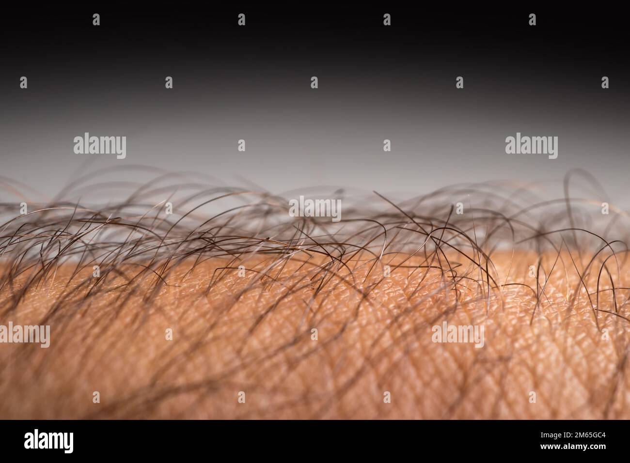 Human skin with hair on dark background. Goose bumps Stock Photo - Alamy