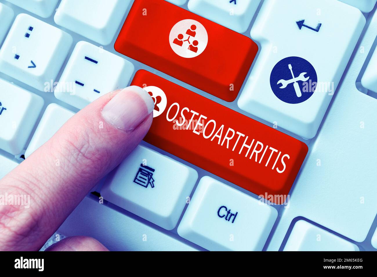 Text sign showing Osteoarthritis. Business approach Degeneration of ...