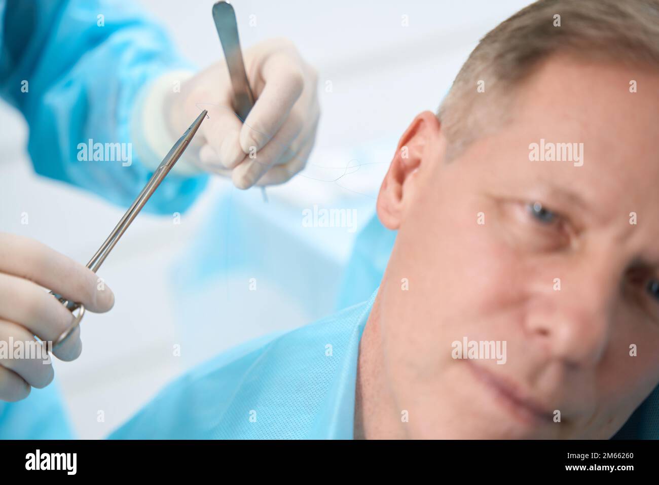 Medical specialsit preparing to put stitches on male patient head Stock ...