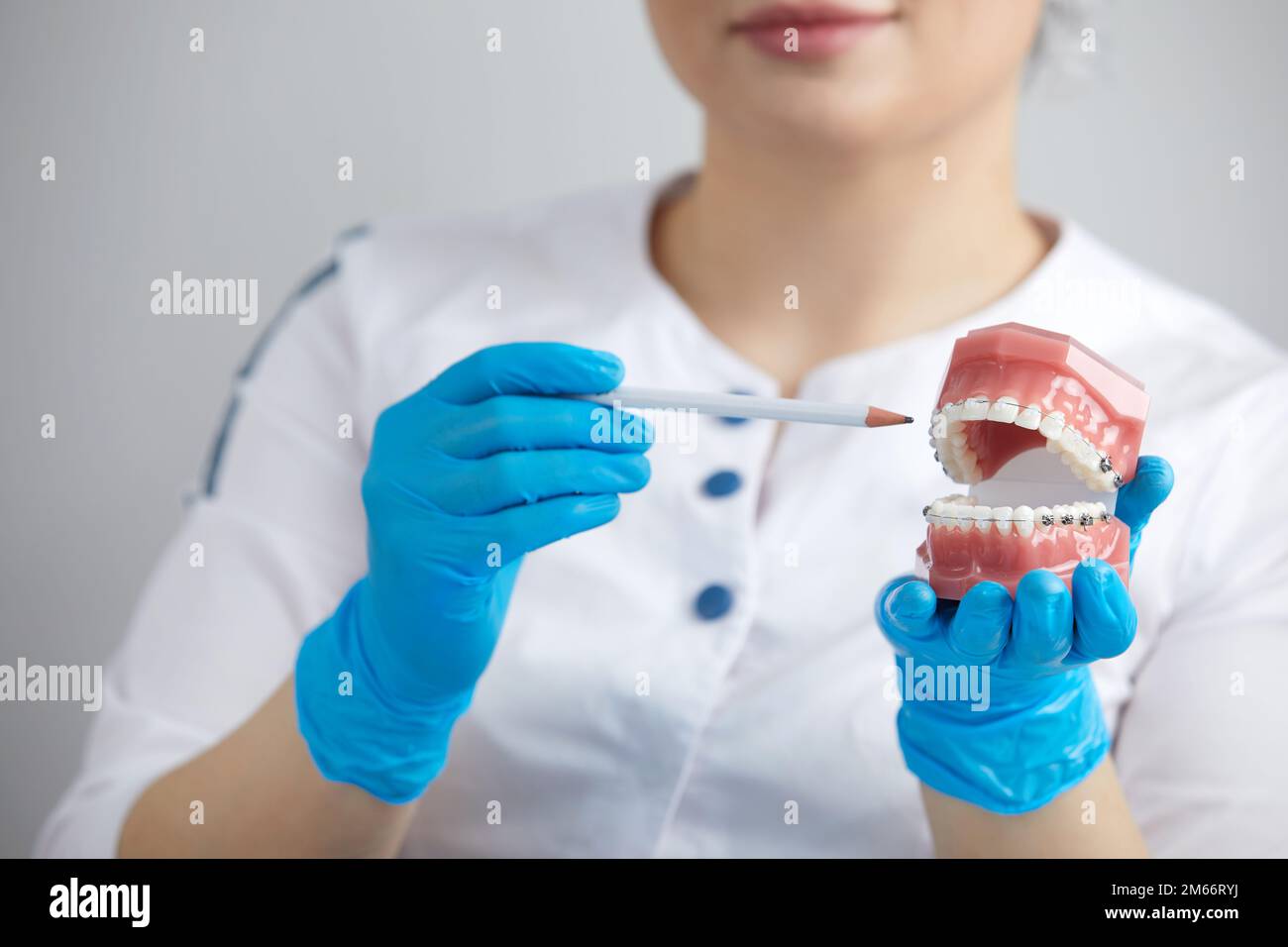 Dentist showing model of human jaw with wire braces and aligners to ...