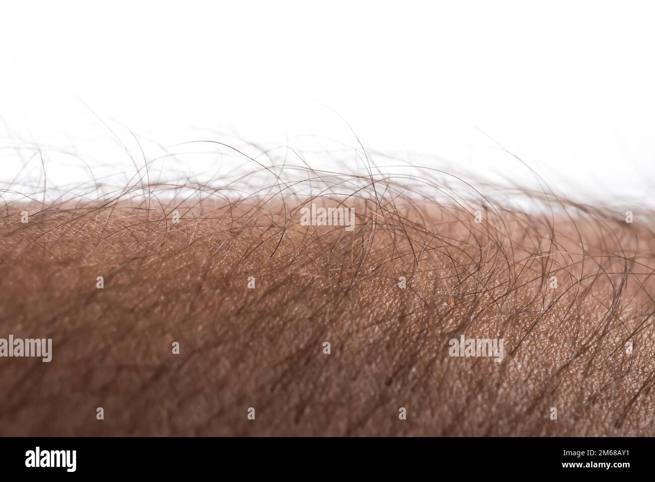 Human skin with hair on white background. Goose bumps Stock Photo - Alamy