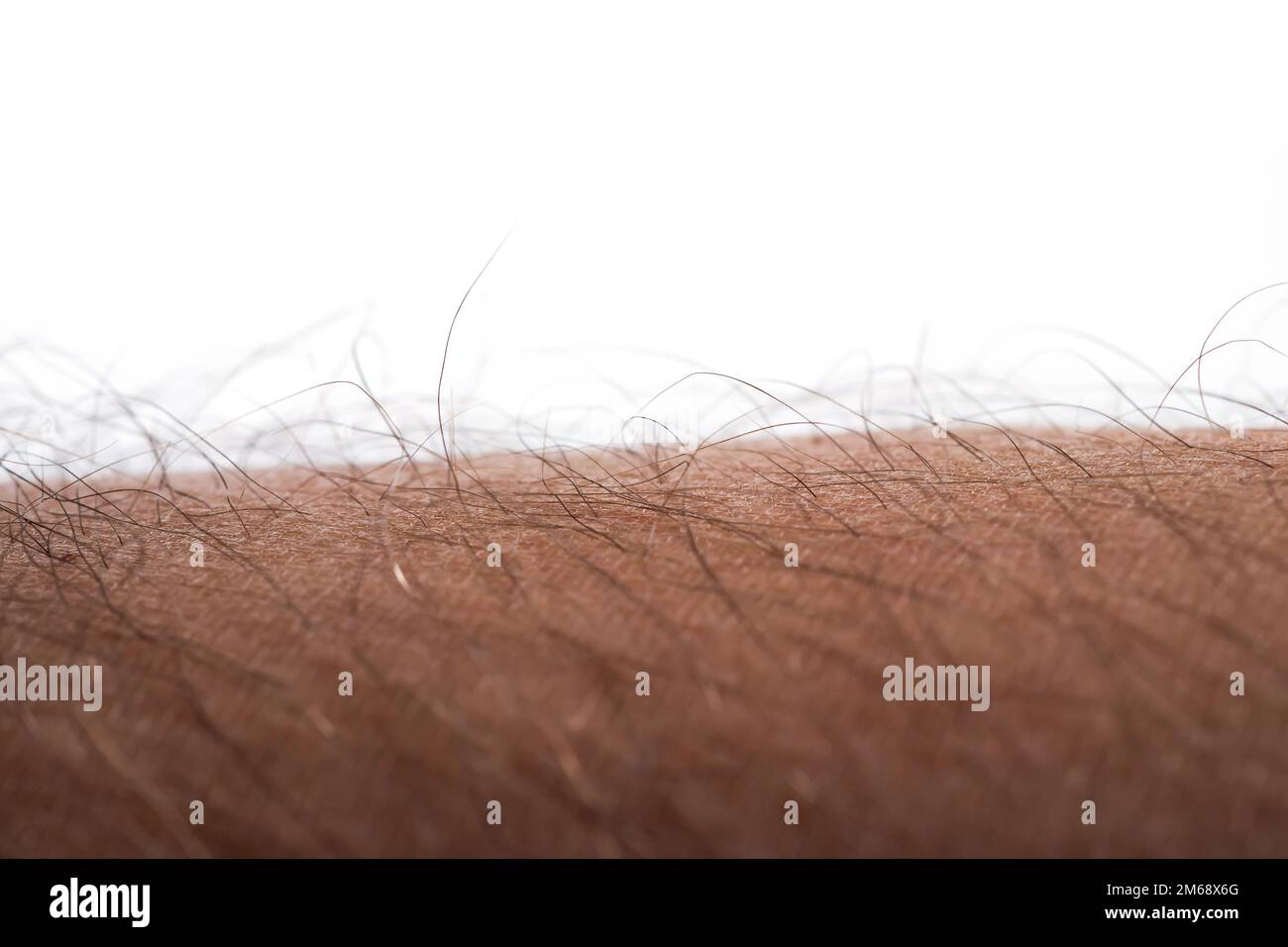 Human skin with hair on white background. Goose bumps Stock Photo - Alamy