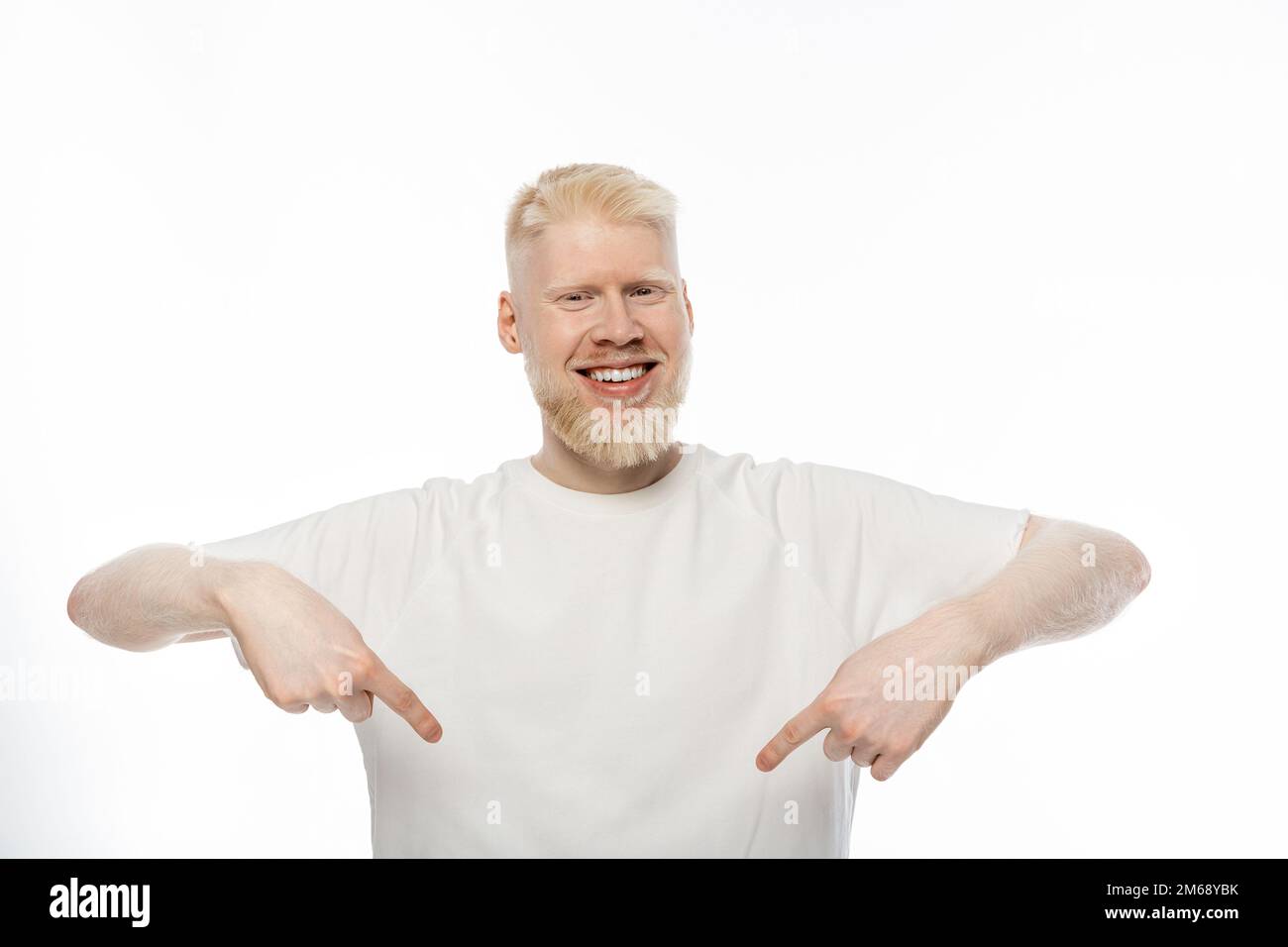 cheerful albino man in t-shirt pointing down with fingers on white ...